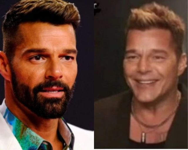 Los supuestos arreglos estéticos en el rostro de Ricky Martin - Tour Atabex